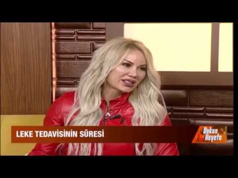 Berlin Estetik TV Programı (TV35) Cilt Yenileme ve Leke Giderme Uygulamaları (1)