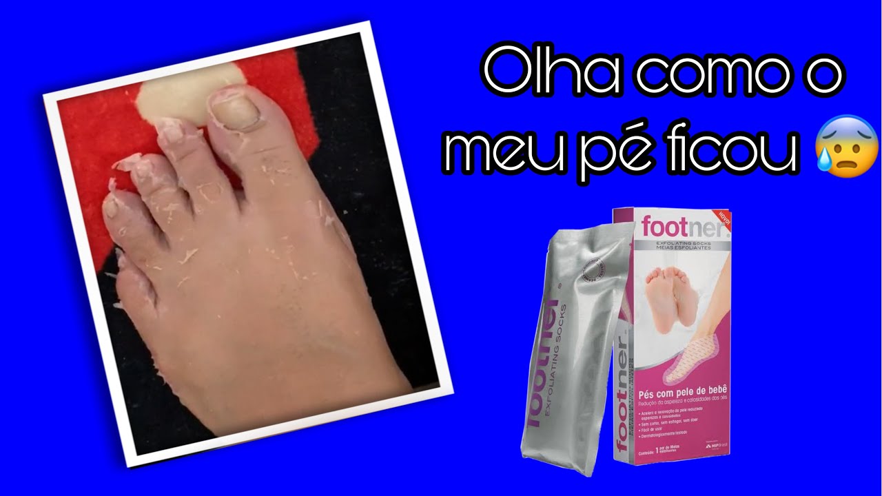 FOOTNER MEIAS ESFOLIANTES | PEELING PARA OS PÉS - YouTube