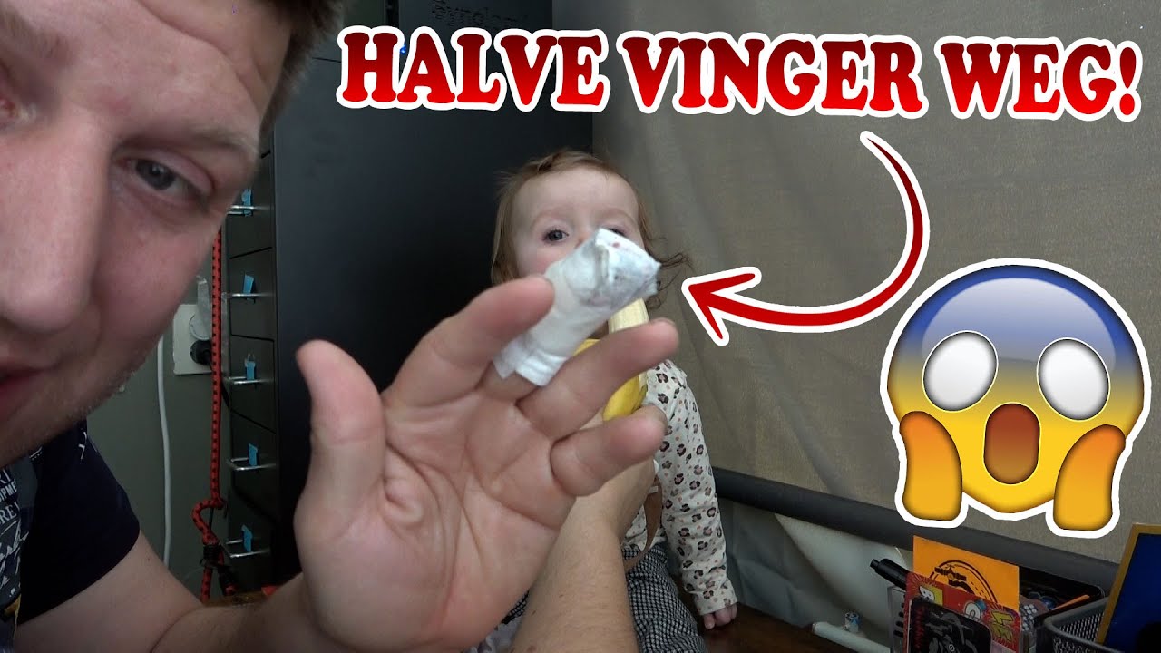 IK BEN EEN HALVE VINGER KWIJT!!! - YouTube