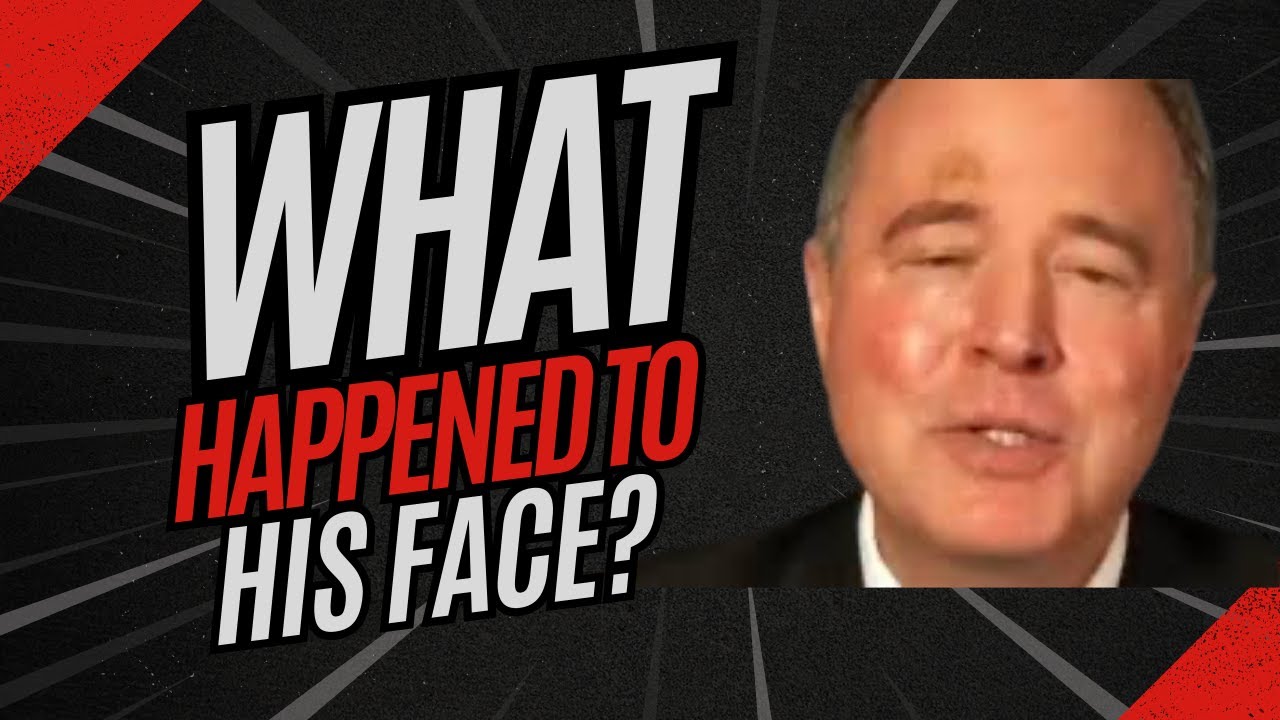 What Happened to Schiff's Face? I Know the Answer - YouTube