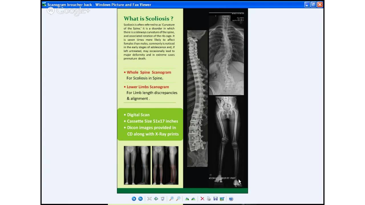 Xray Scanogram Youtube Scanogram Both Lower Limb🏥 . . #xray_doctor