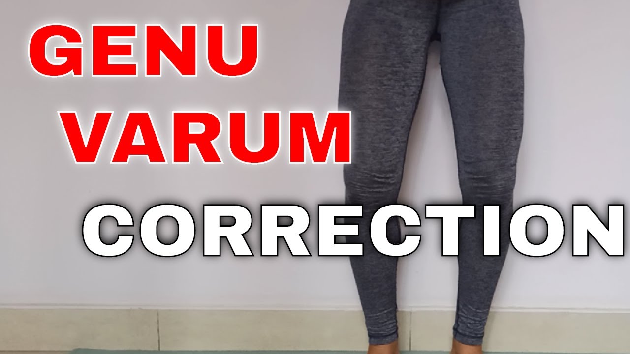 5 GENU VARUM CORRECTION EXERCISES - Yoga For Bow Legs - YouTube