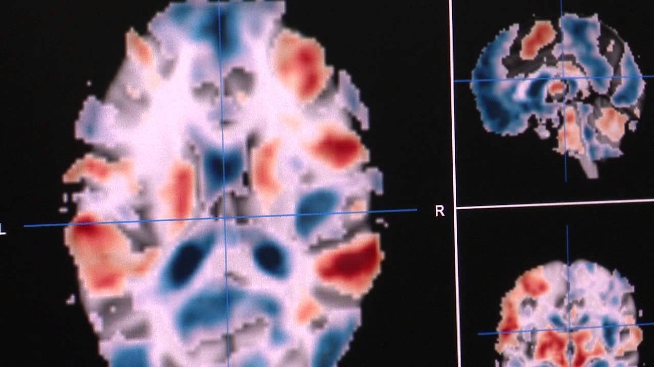 OpenfMRI allows neuroscientists to share brain research data - Science ...