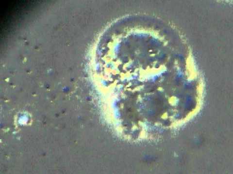Tissue culture contamination - YouTube