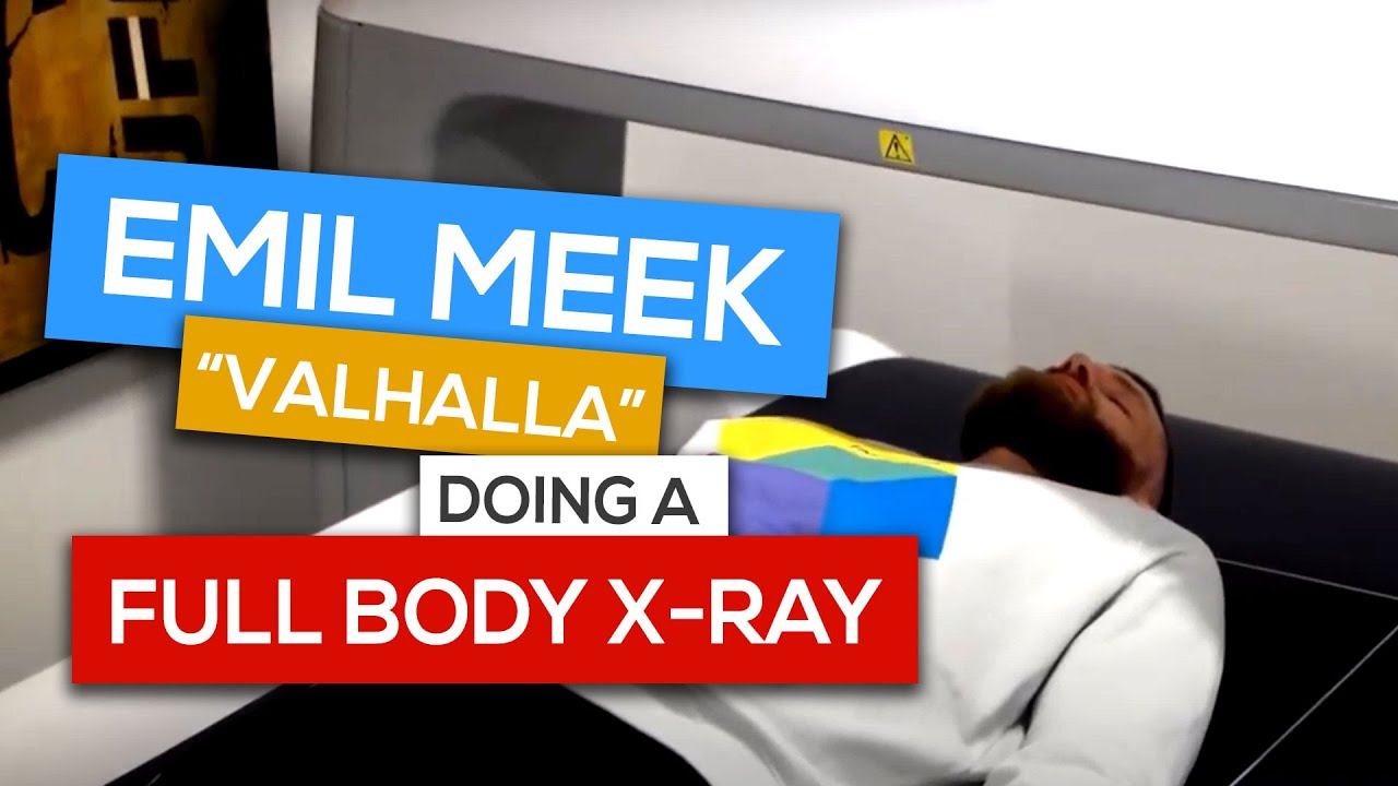 Emil "Valhalla" Meek doing a full body x-ray | Evolve Combat Vlog 3 ...