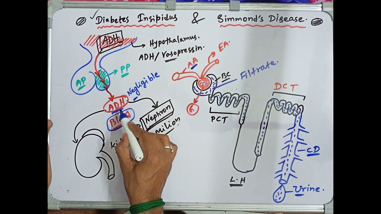 Diabetes Insipidus & Simmond's Disease | Simplified for NEET - YouTube