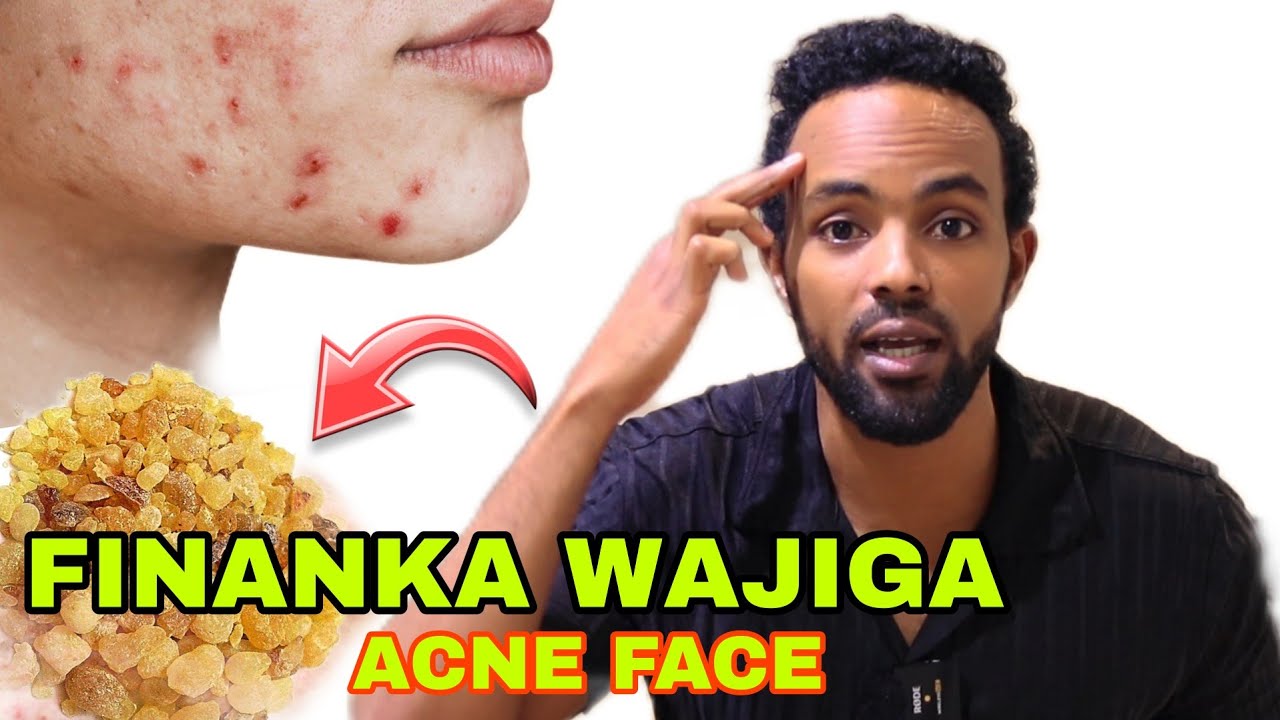 2 SHAY FINANKA WAJIGA LAGU DAWEEYO - YouTube