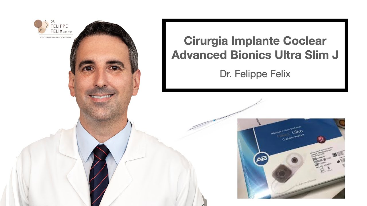 Implante Coclear Advanced Bionics Ultra Slim J - Dr. Felippe Felix ...