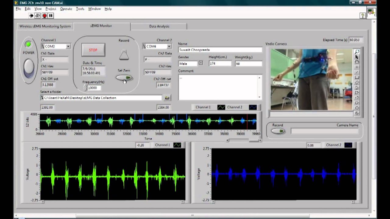 EMG Biofeedback Hands On Physical Therapy and Athletic Rehabilitation ...