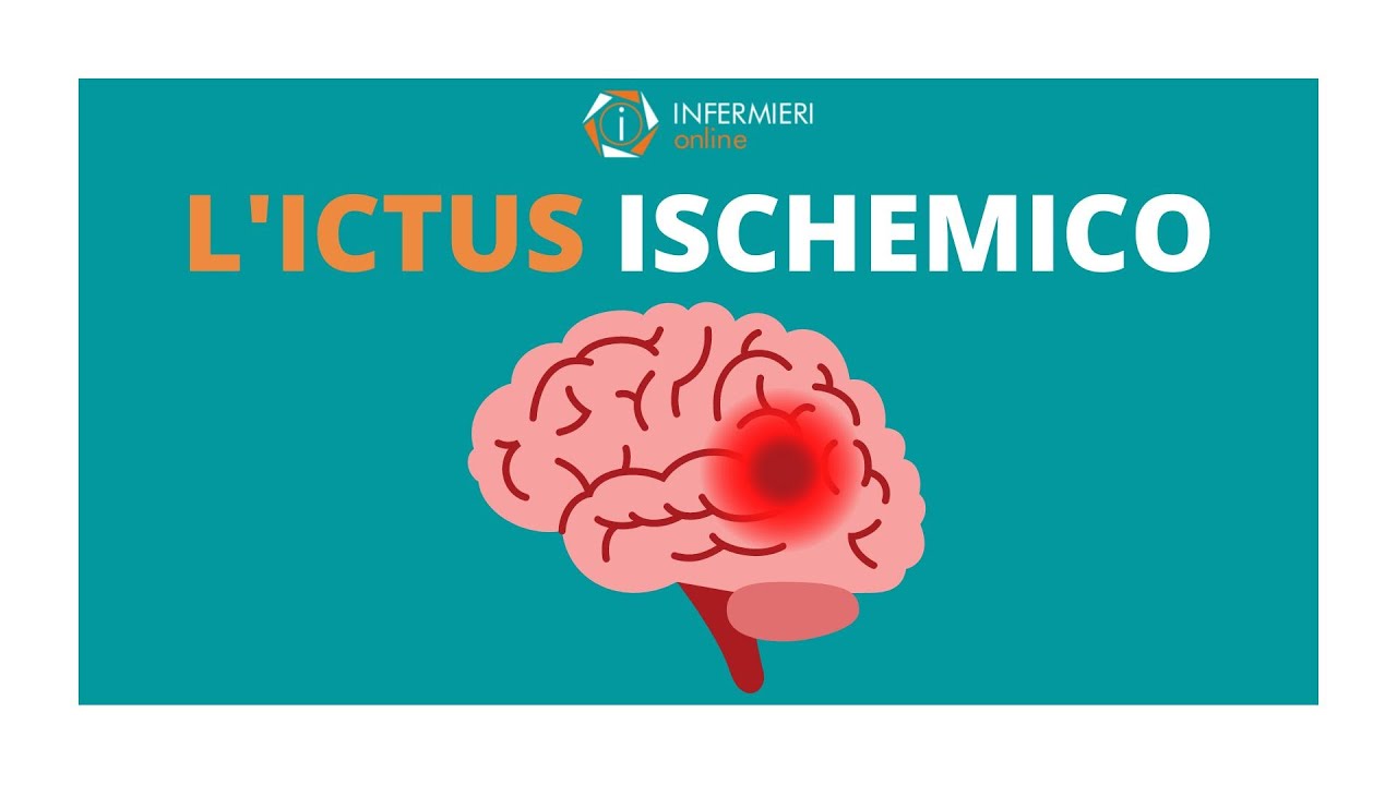 L'ICTUS ISCHEMICO | STROKE | INFERMIERI Online - YouTube