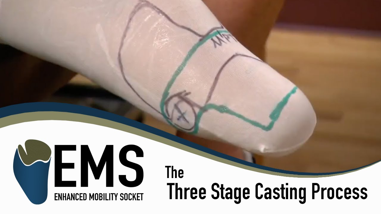 EMS: Enhanced Mobility Socket » 3-Stage Casting Process - YouTube