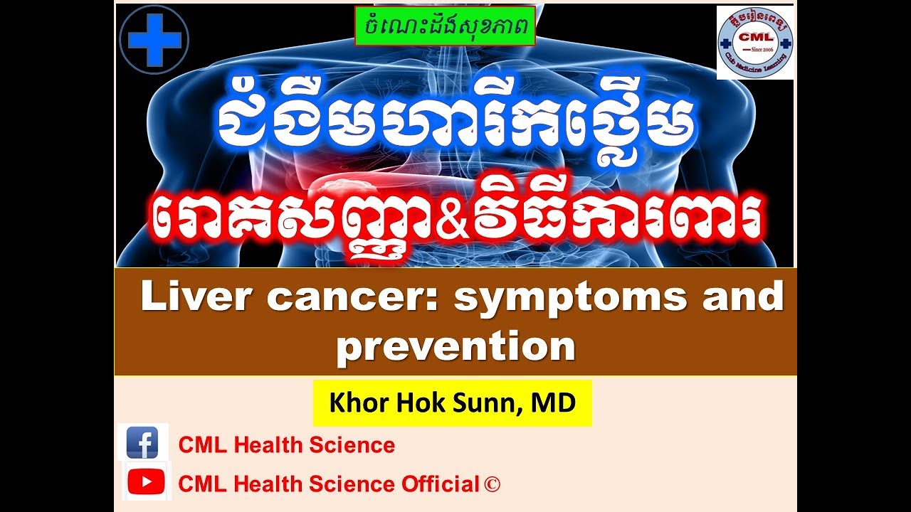 ជំងឺមហារីកថ្លើមរោគសញ្ញា និង វិធីការពារl Liver cancer symptoms and ...