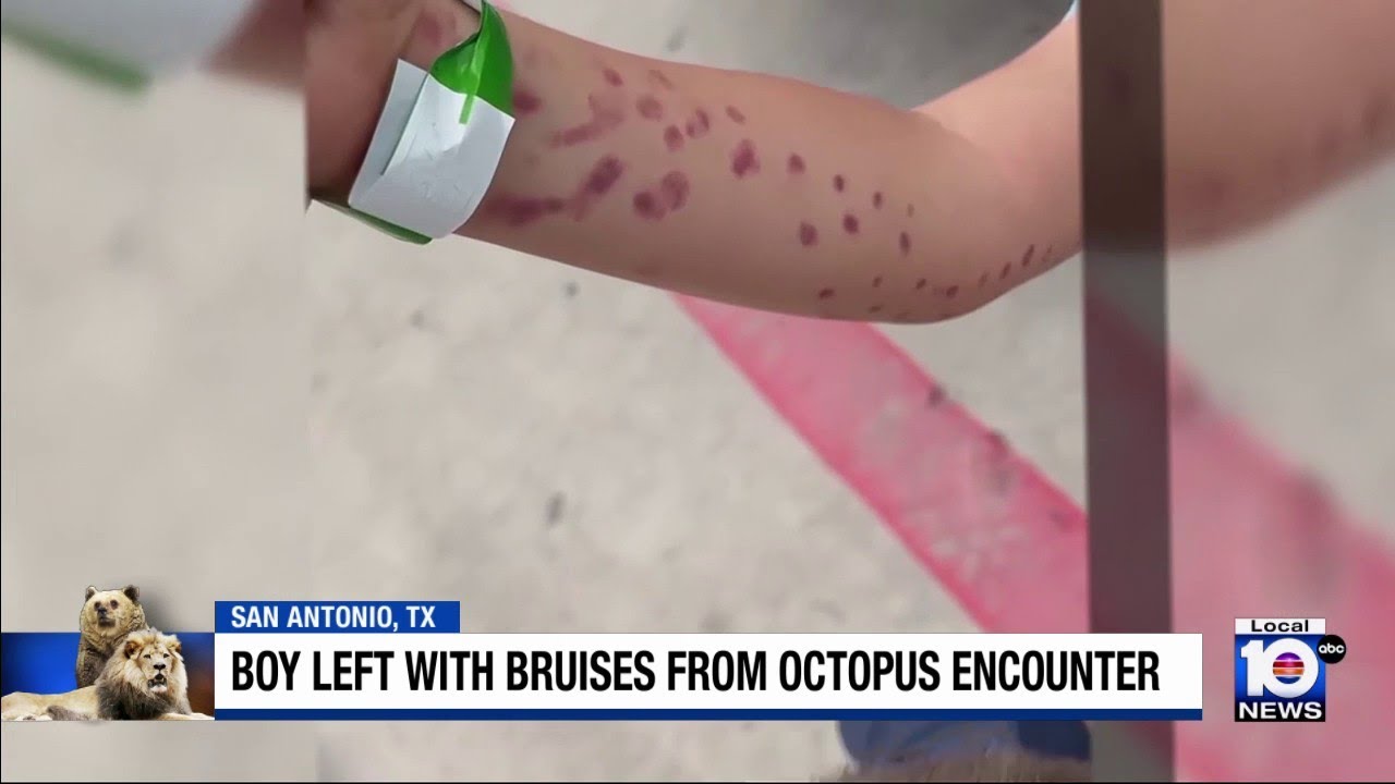 Boy injured after interaction with octopus at San Antonio aquarium ...