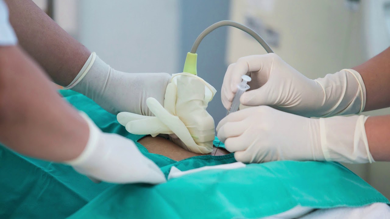 Paracentesis (guiada por US/ultrasonido) - YouTube