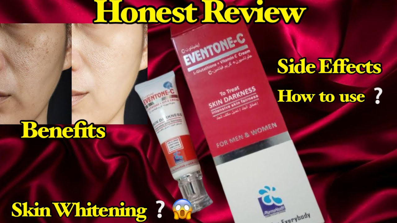 Eventone C Cream Review | Eventone c cream side effects | Skin ...
