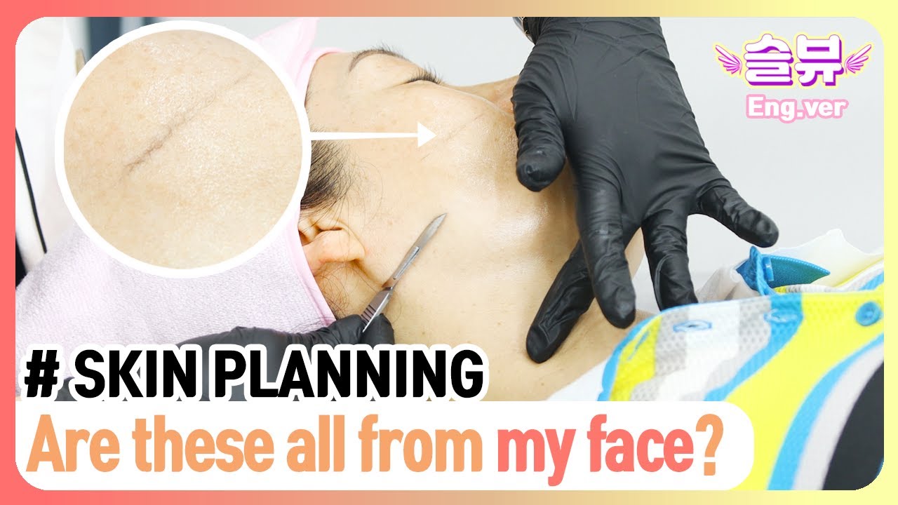 [SKIN PLANNING Education] Are thse all from my face? / the skin ...