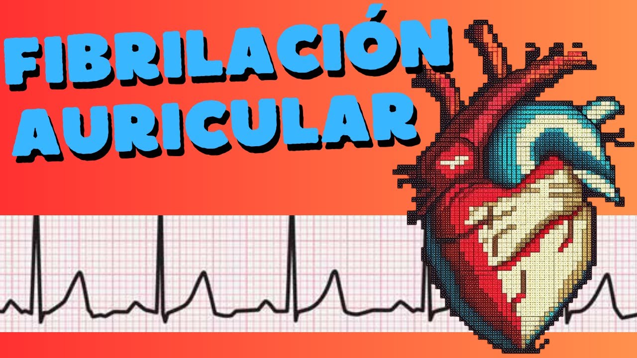 ¿Qué es la fibrilación auricular? - YouTube
