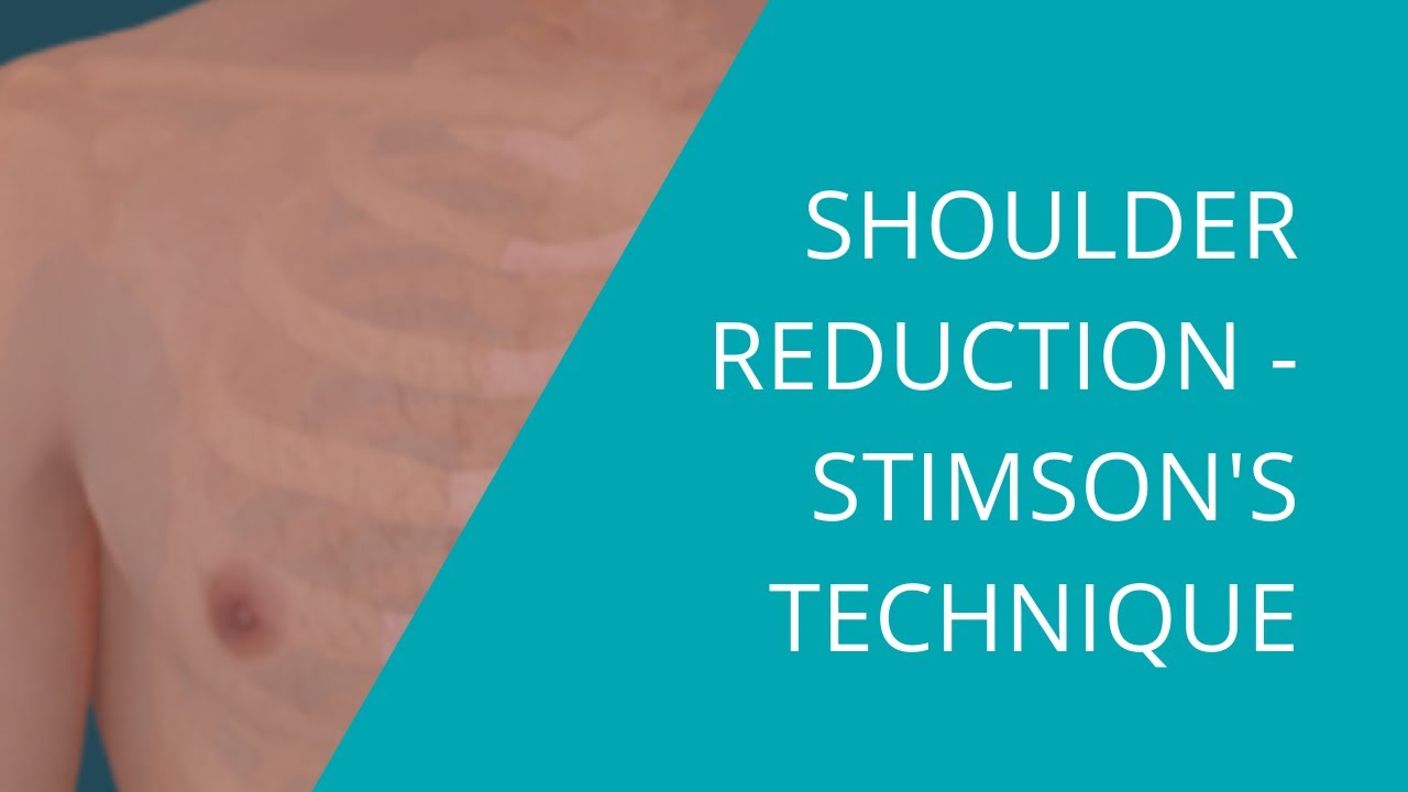 Shoulder Reduction Stimson's Technique - YouTube