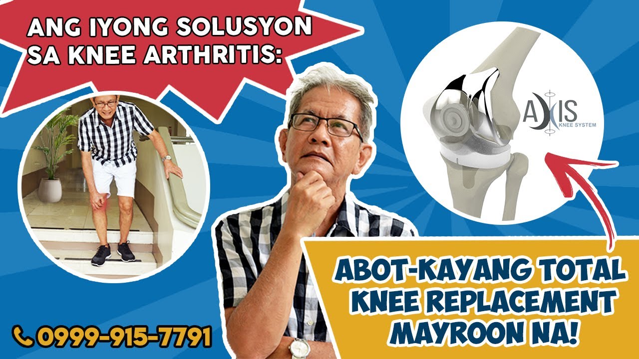 Axis Knee System Informational Video - Ano ang total knee replacement ...
