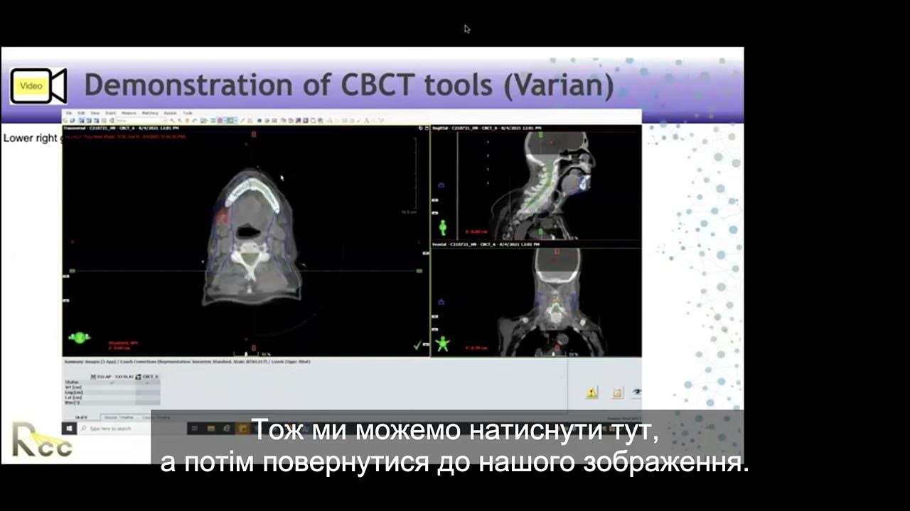 Session 11 - IGRT: Image-Matching Workshop in CBCT - YouTube