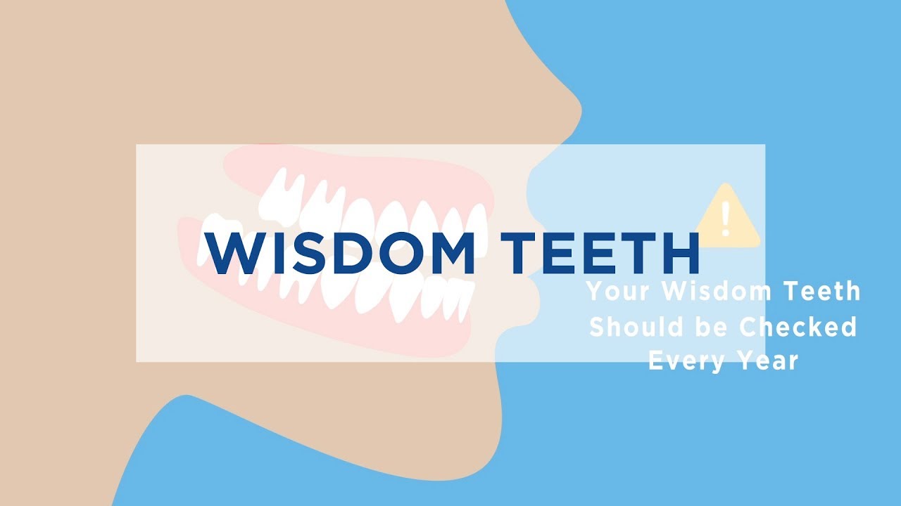 Wisdom Teeth: Impacted or Crowding (:30) - YouTube