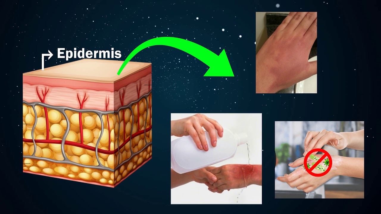 First aid for Burns and Cuts | Treatment for burning - YouTube