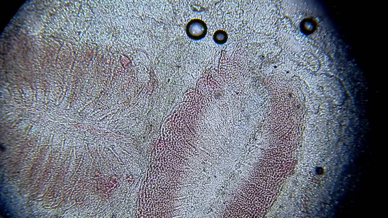 Gill biopsy wet preparations - what do you look for when viewing under ...