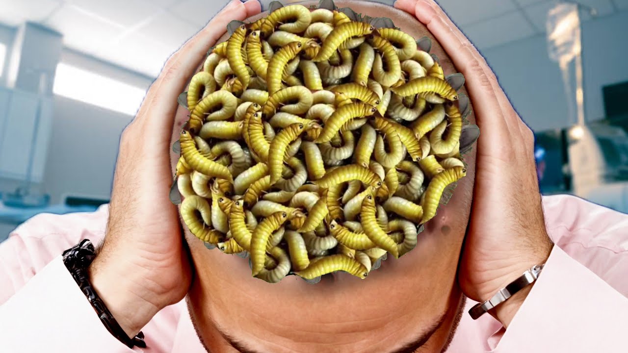 ASMR Removes large inflamed pimples on the head & Parasitic maggots | Deep Cleaning Animation ...