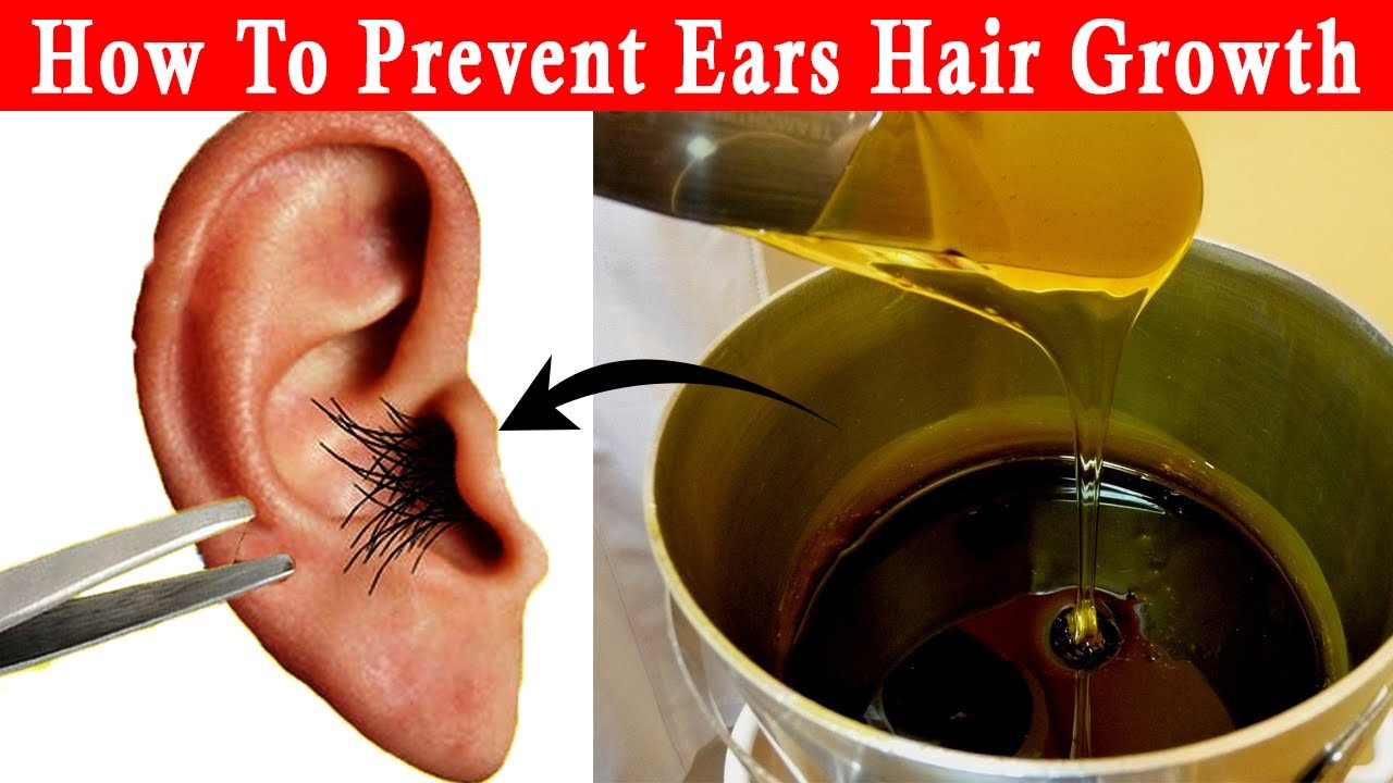 Hair Removal: How To Prevent Ears Hair Growth - YouTube