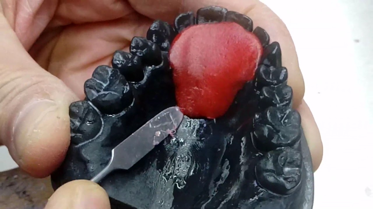 Isolation on Lcd resin model and PATTERN RESIN (salt pepper resin ...