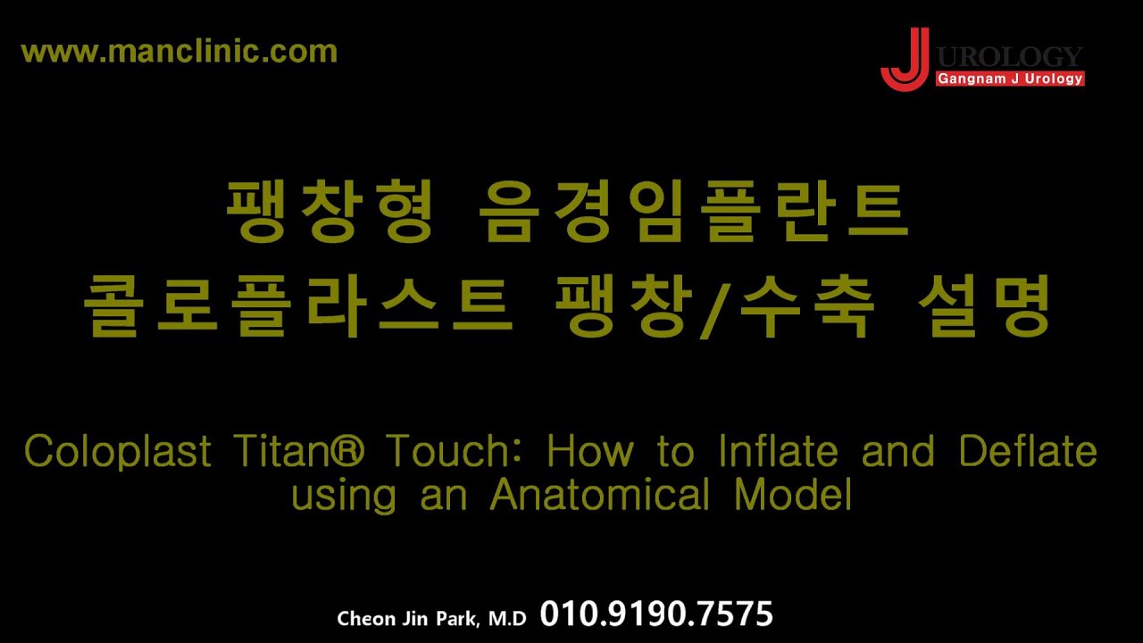 팽창형 음경임플란트콜로플라스트 팽창/수축 설명Coloplast Titan®Touch: How to Inflate and ...