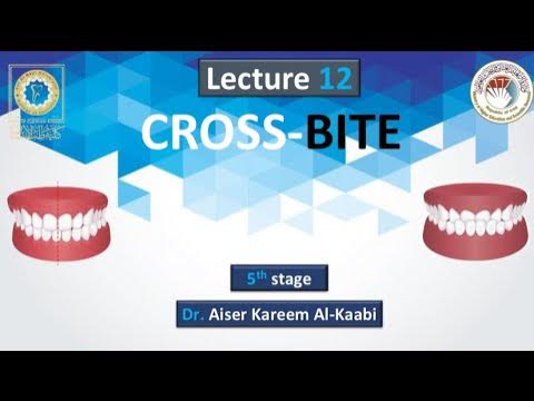 Crossbite Lec.12 stage5 - YouTube