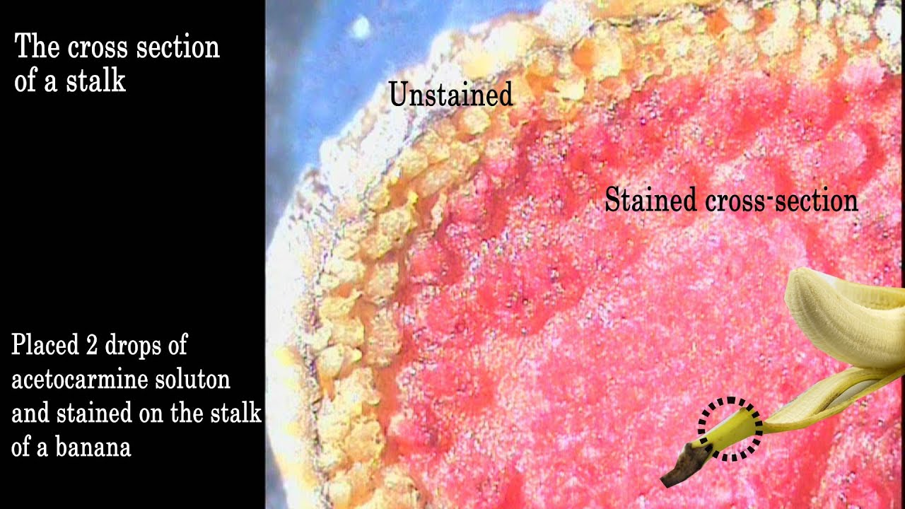 Microscopic video of banana stalk (tap) (vascular bundle, xylem, phloem ...