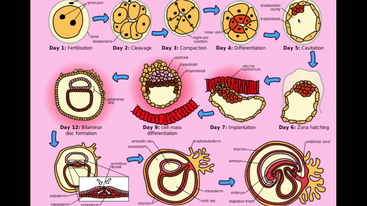 Multiple Gestation (Twins) - CRASH! Medical Review Series - YouTube