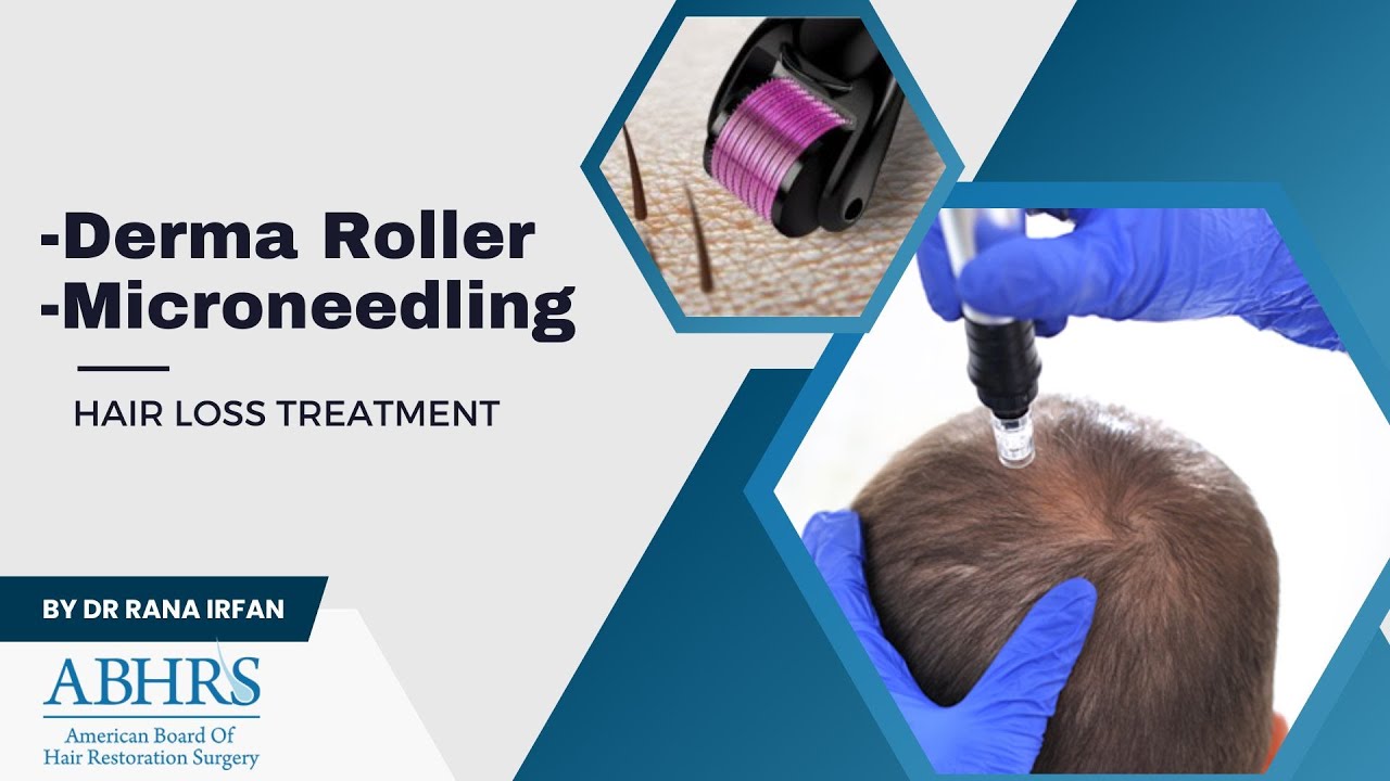 Derma Roller and Microneedling For Hair Loss Treatment || Non-Surgical ...