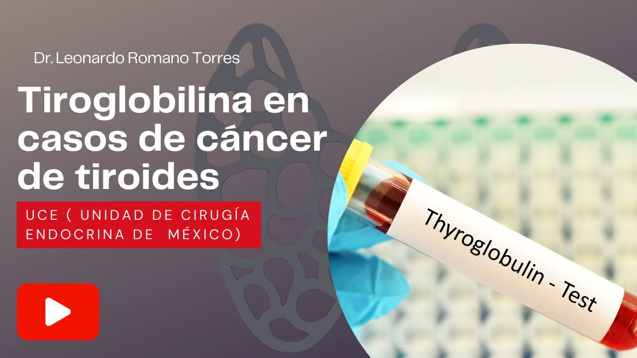 ¿Es importante la Tiroglobulina en el Seguimiento del Cáncer de ...