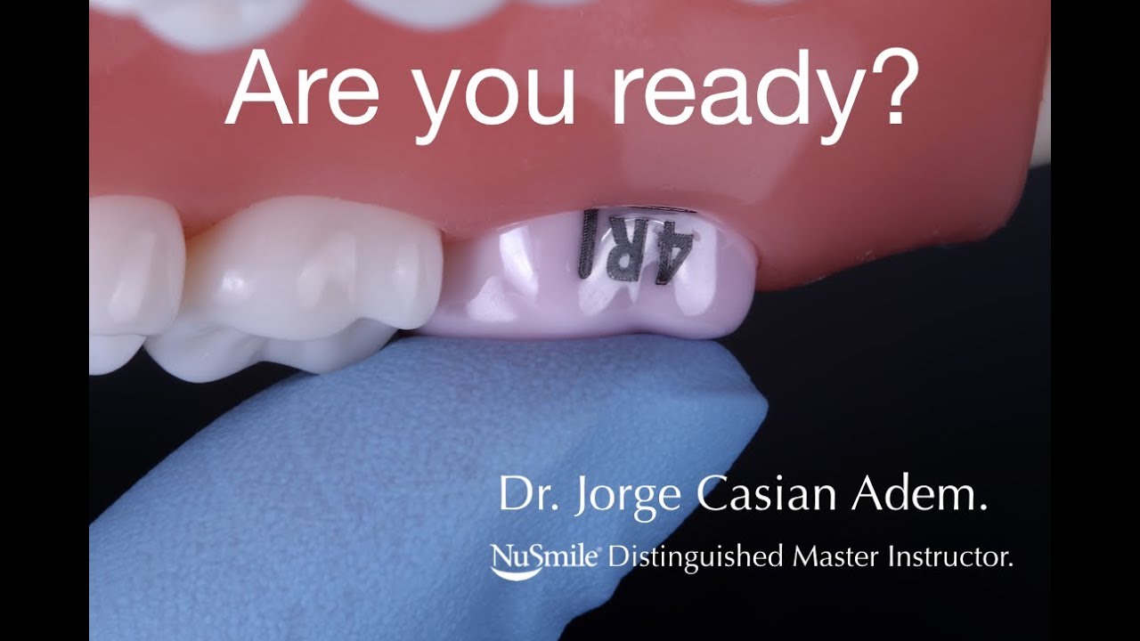 Nusmile Anterior Crowns Cheapest Factory | www.oceanproperty.co.th