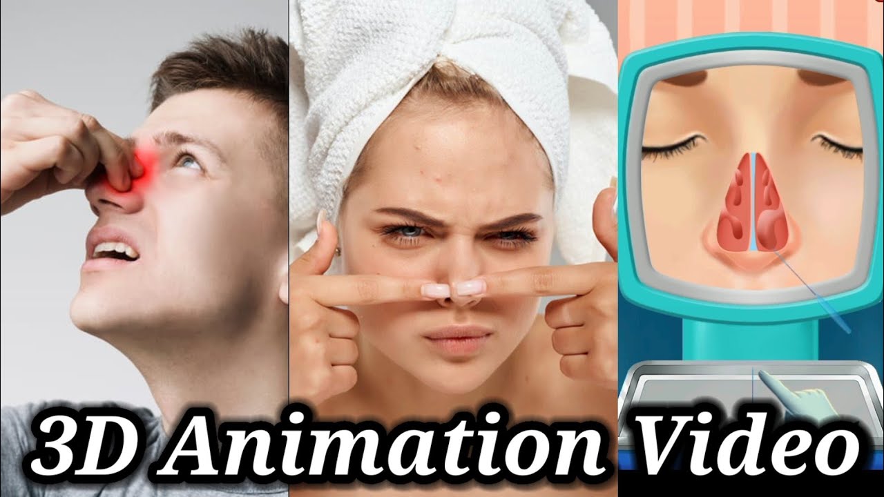 The Patient is Uncomfortable Due To The Problem of Inflammation 🤔 || 3D ...