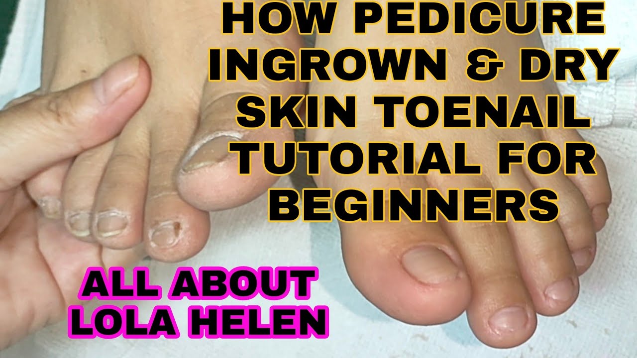 HOW PEDICURE INGROWN & DRY SKIN TOENAIL TUTORIAL FOR BEGINNERS - YouTube
