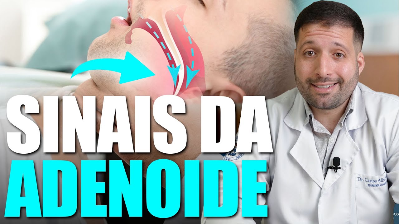 ADENÓIDE: SINTOMAS, O QUE É E COMO TRATAR? - YouTube