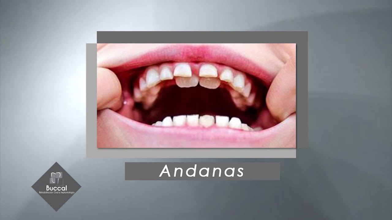 ANDANAS #1 - YouTube