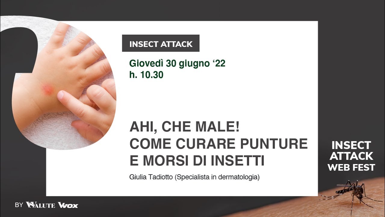 AHI, CHE MALE! COME CURARE PUNTURE E MORSI DI INSETTI - YouTube