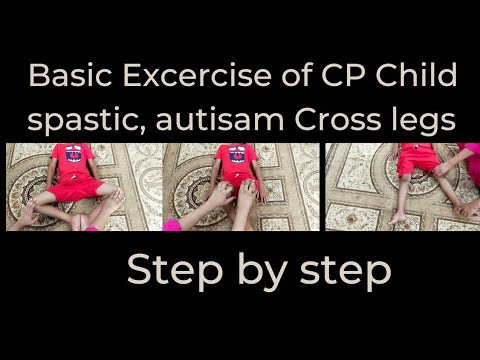 CP Child Exercise from start/step by step/spastic/ autisam/cross leg ...