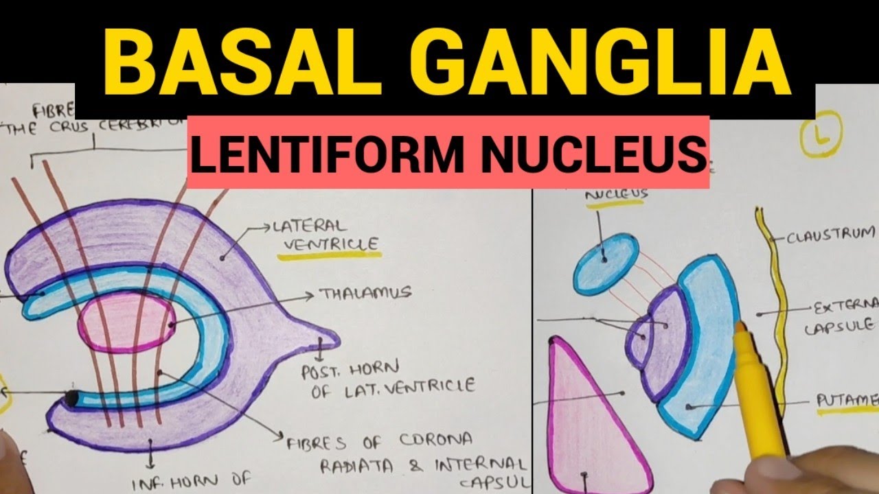 Lentiform Nucleus Internal Capsular Stroke Physiopedia