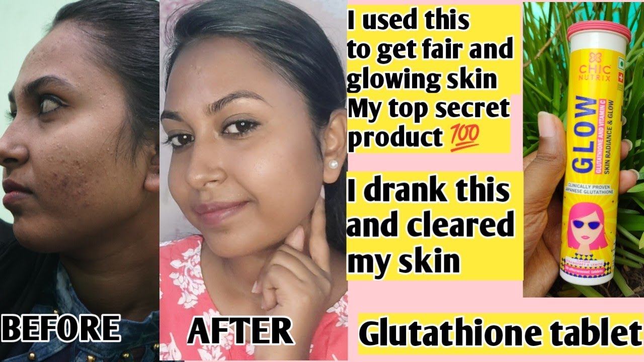 Chicntrix Glow |என் முகம் glowing யா இருக்க நான் இந்த glutathione ...