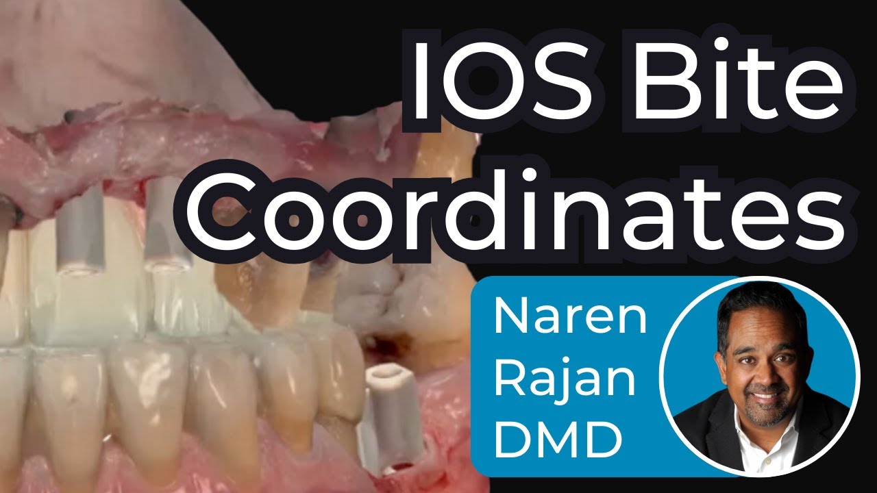 Capture the IOS bite and keep it as you progress with Dr. Naren Rajan ...