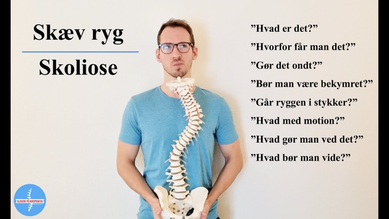 Hvad er en skæv ryg (skoliose)? - YouTube