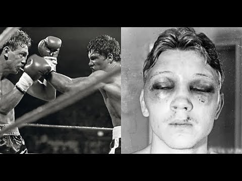 Tragedia, która wstrząsnęła boksem [WSPOMNIENIE] - YouTube
