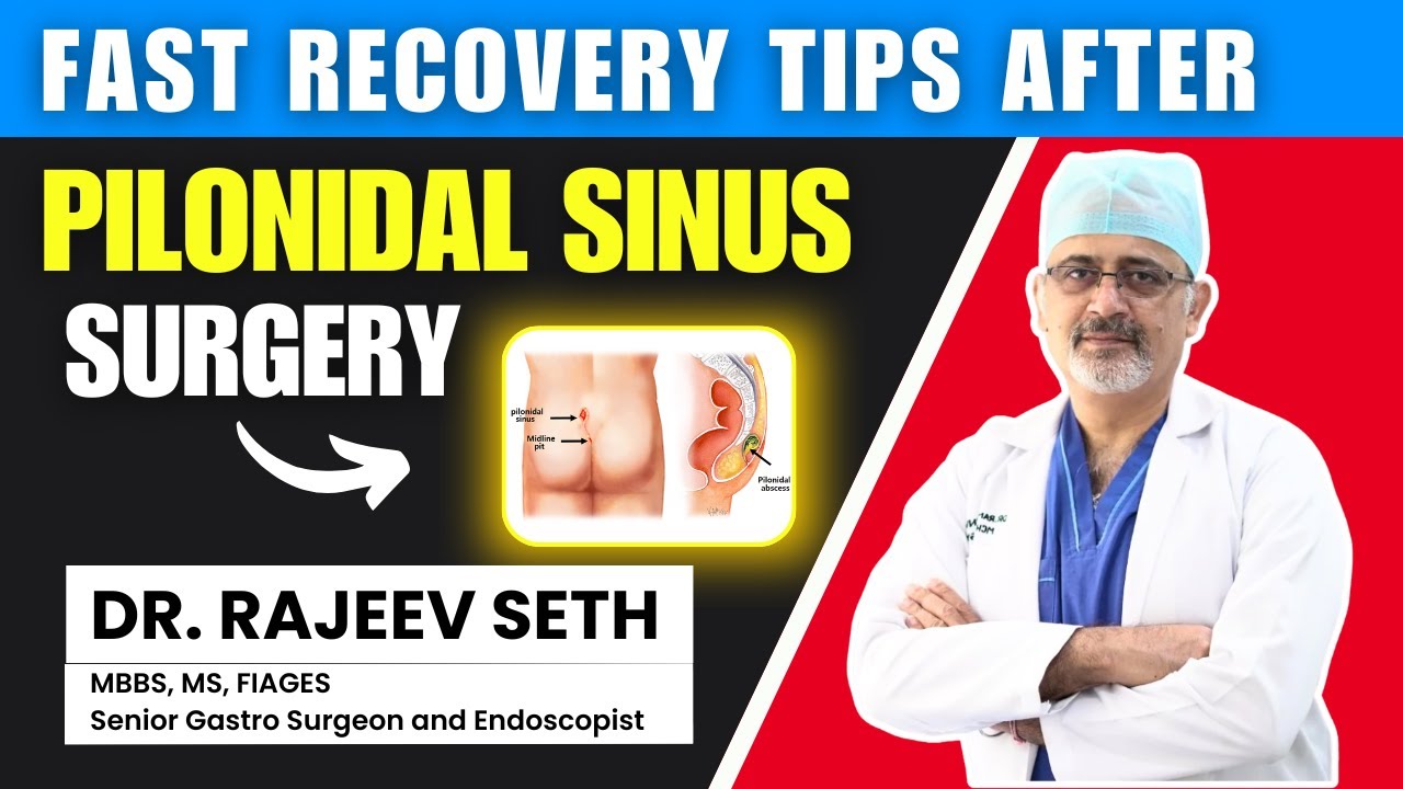 Fast Recovery Tips After Pilonidal Surgery! || Dr Rajeev Seth # ...