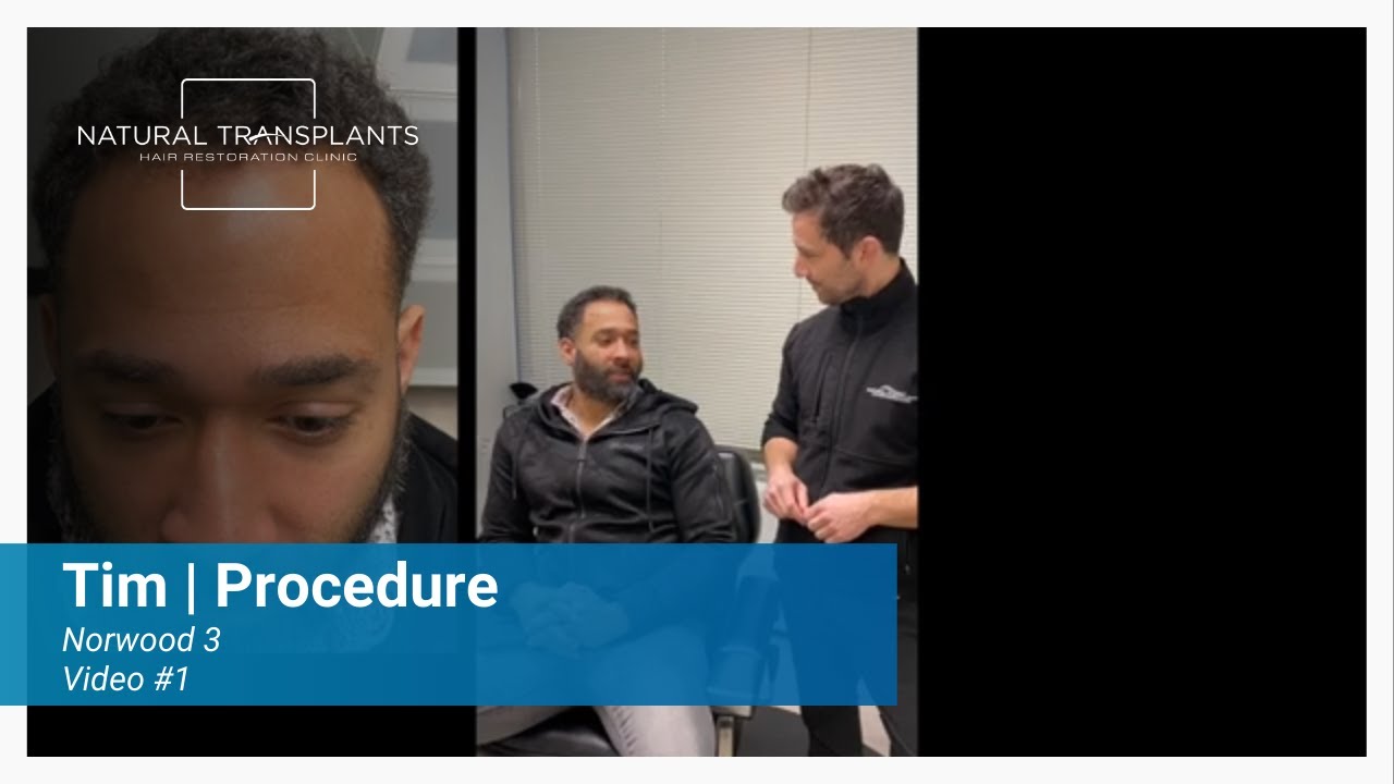 Procedure Day: Norwood 3 Patient Hairline Restoration | Dr. Blumenthal ...